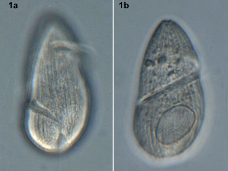 ギムノディニウム科 | 分類体系 | JAMBIO沿岸生物データベース