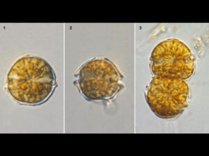 Alexandrium属の一種_01 | JAMBIO沿岸生物データベース