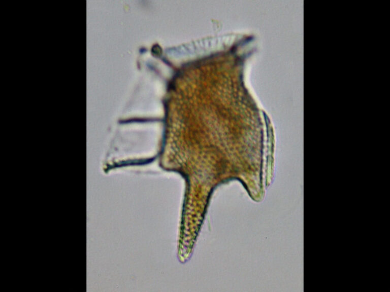 Dinophysis tripos | JAMBIO沿岸生物データベース