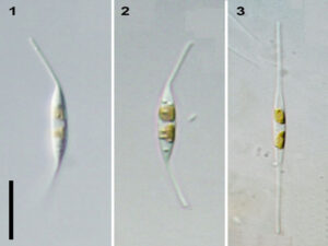 Ceratoneis closterium | JAMBIO沿岸生物データベース