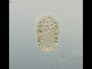 Corethron hystrix | JAMBIO沿岸生物データベース