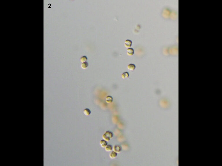 Phaeocystis globosa | JAMBIO沿岸生物データベース